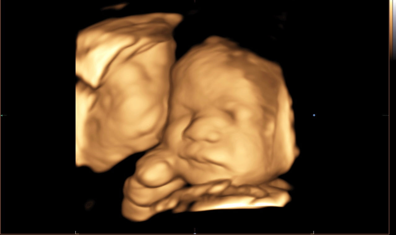 8K Ultrasound Image – Oh Baby Ultrasound + Boutique