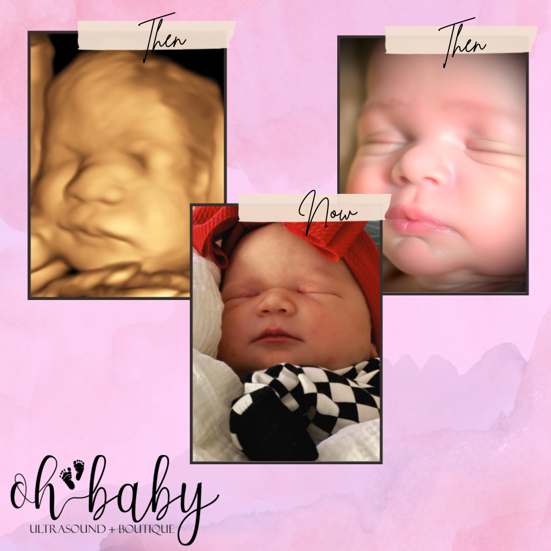 8K Ultrasound Image – Oh Baby Ultrasound + Boutique